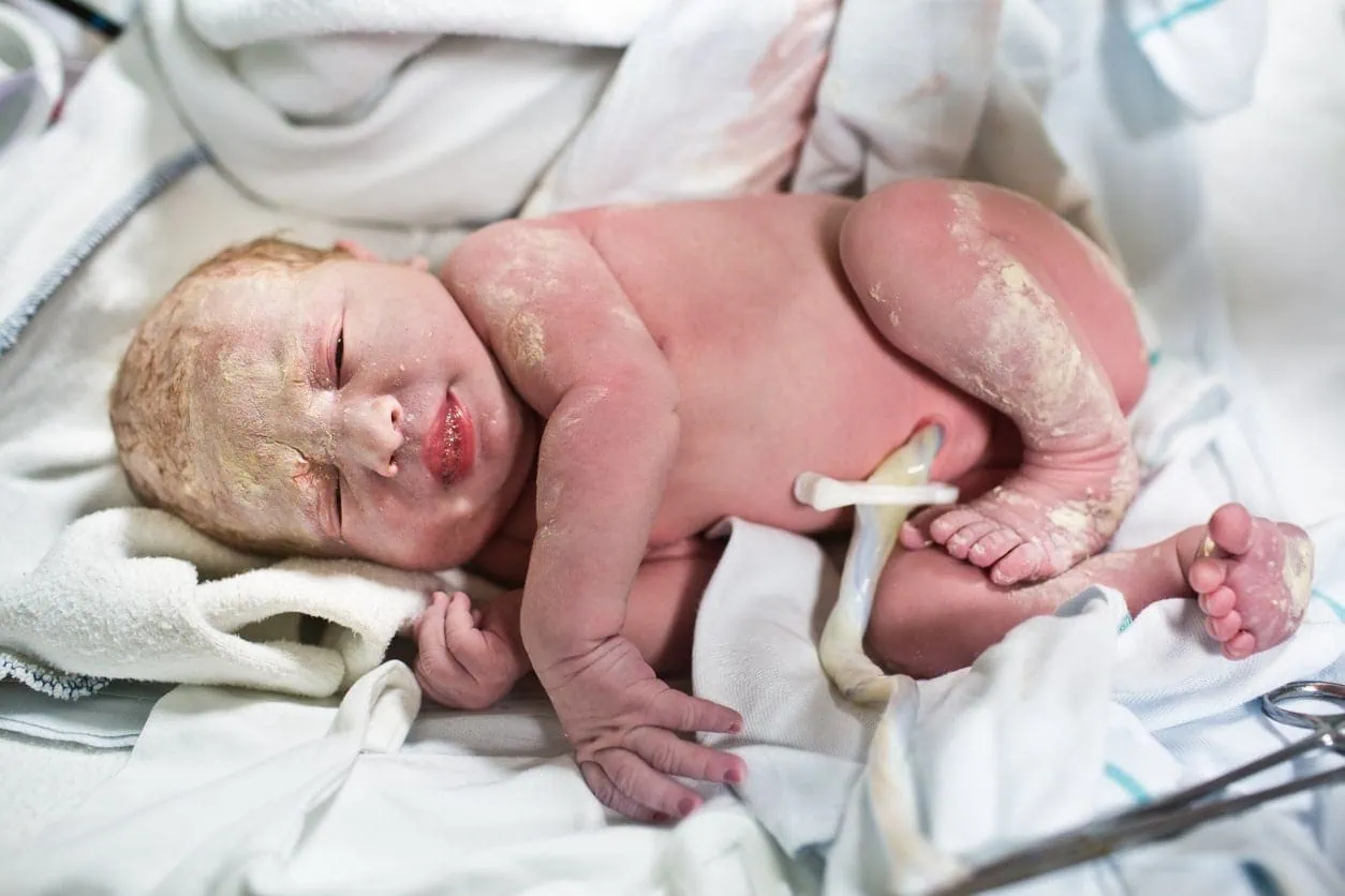 Delayed Cord Clamping: What It Is, Benefits, and Risks - Baby Chick
