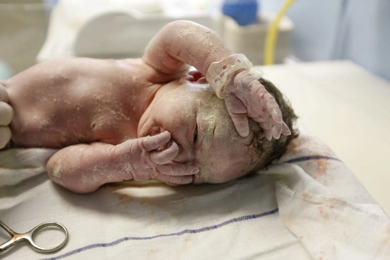 What Is Vernix and Why Is It All Over My Newborn? - Baby Chick