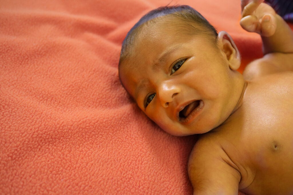 What Is Jaundice in Newborns and How Is It Treated? - Baby Chick