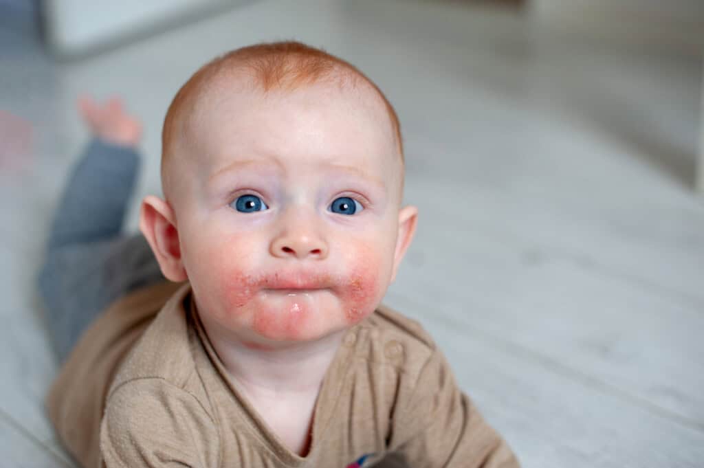 First Aid for Babies: Common Emergencies and What To Do