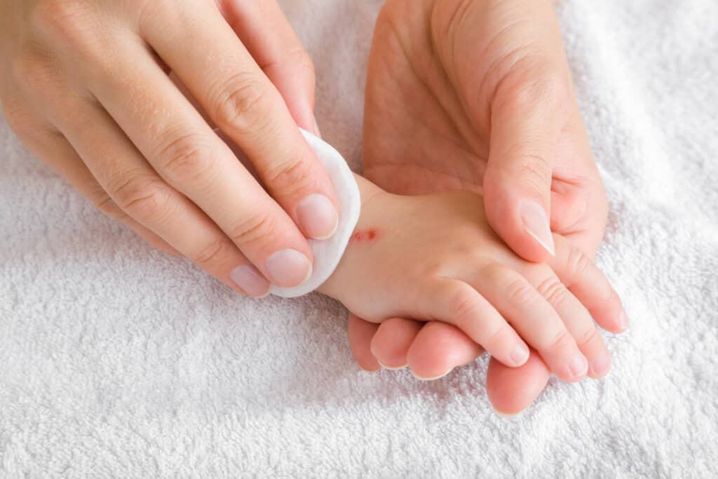 First Aid for Babies: Common Emergencies and What To Do