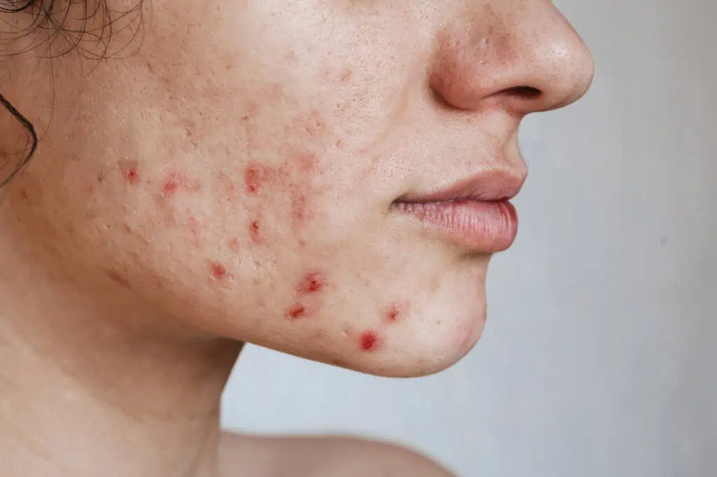 Pregnancy Safe Skincare Products We Love - Baby Chick